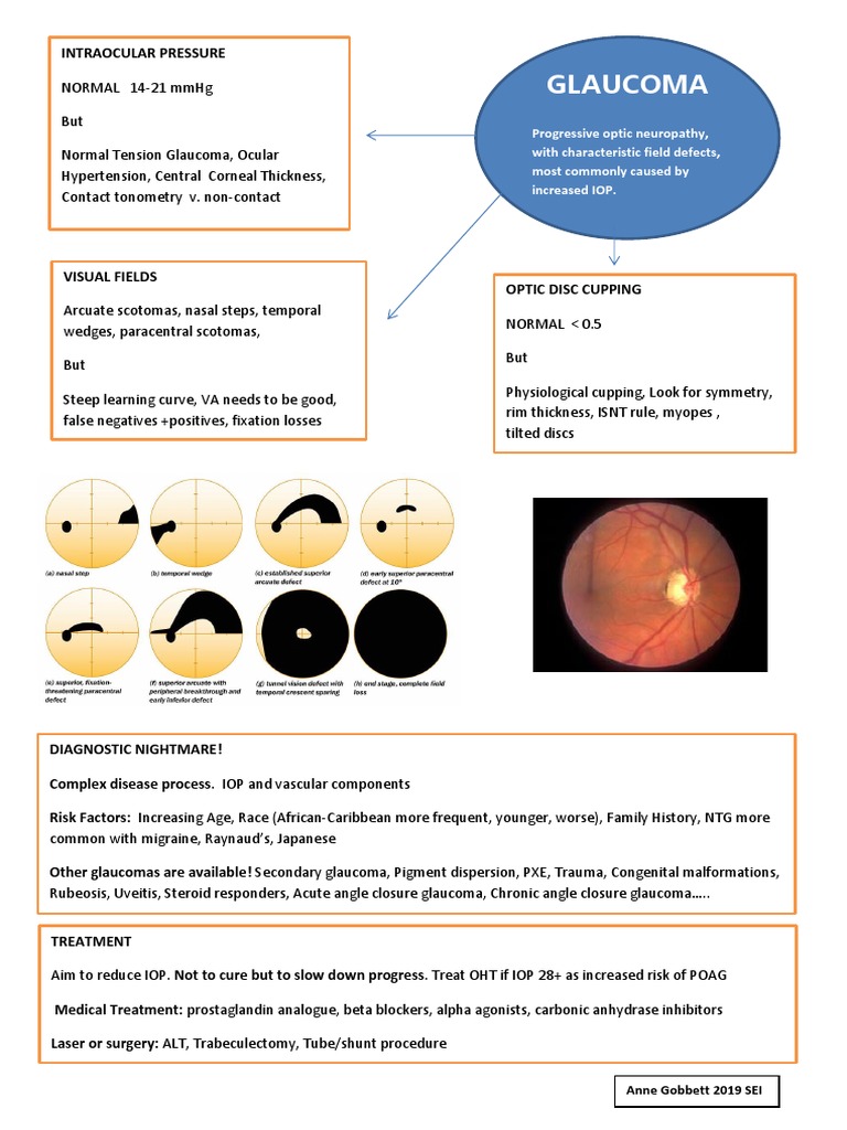 Glaucoma: Types, Diagnosis, and Treatment | PDF | Science & Mathematics