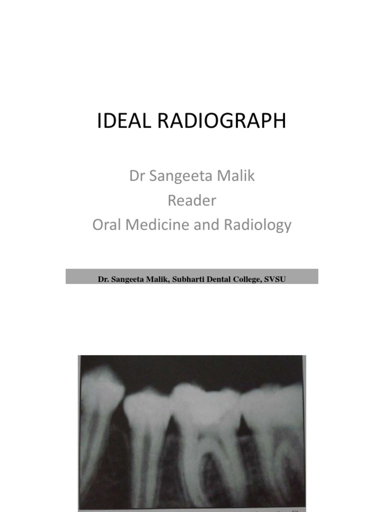 Characteristics of an Ideal Radiograph and Factors Affecting ...
