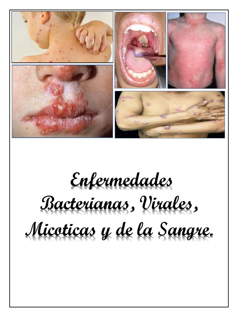 Enfermedades Virales, Bacterianas y Micoticas | PDF | Medicina CLINICA | Inmunología