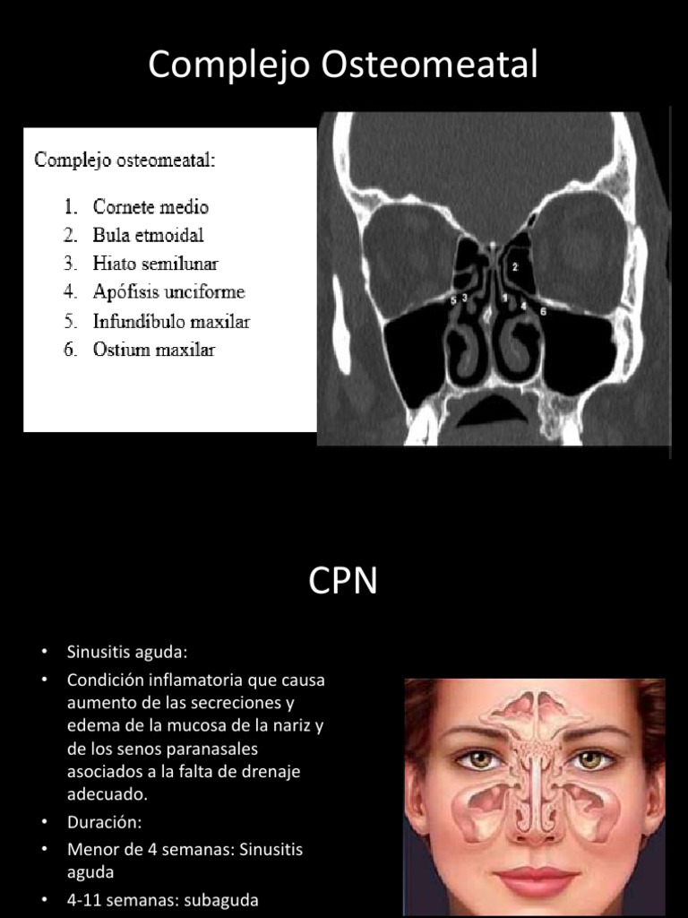 Complejo Osteomeatal | PDF