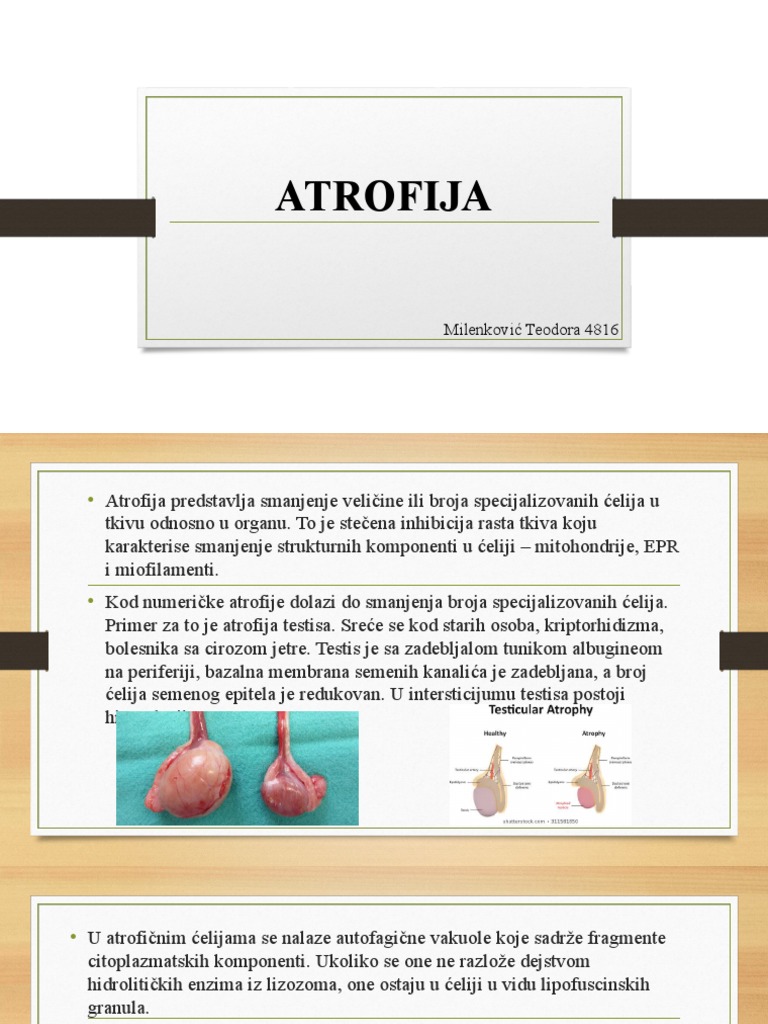 Atrofija: Milenković Teodora 4816 | PDF