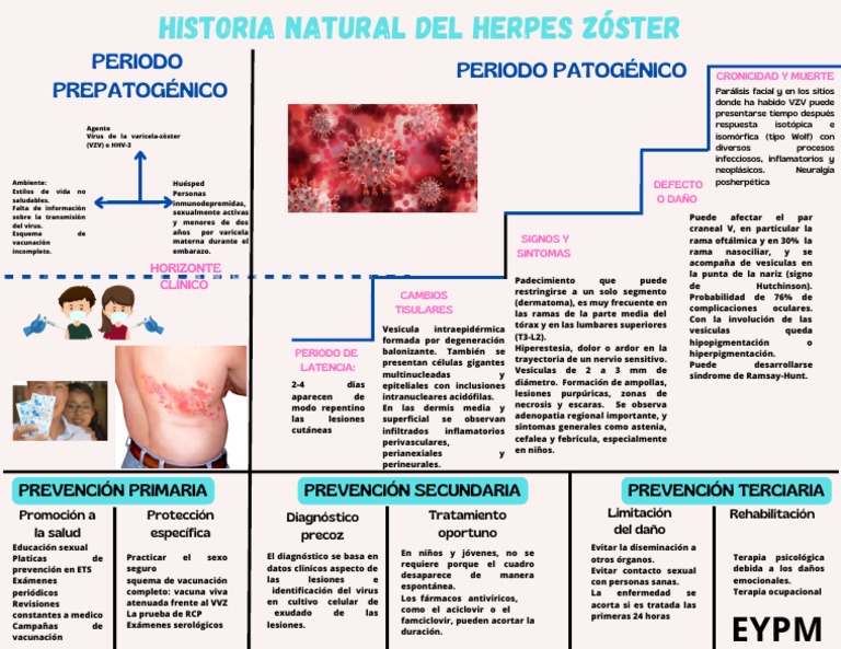 Historia Natural Del Herpes Zoster | PDF