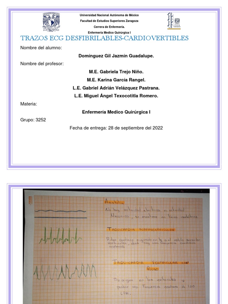 Trazos ECG Desfibrilables y Cardioversiones | PDF