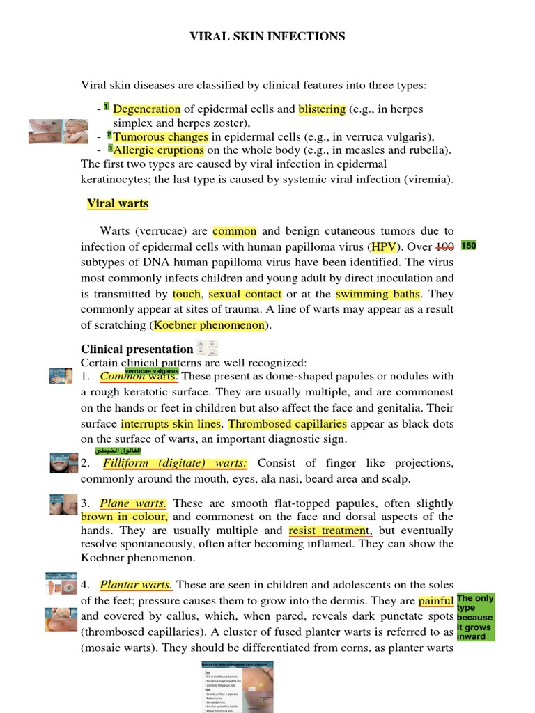 Viral Skin Infections: Verrucae Valgarus | PDF | Herpes Simplex ...