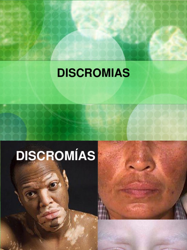 Tipos y causas de discromías cutáneas | PDF | Piel | Enfermedades y ...