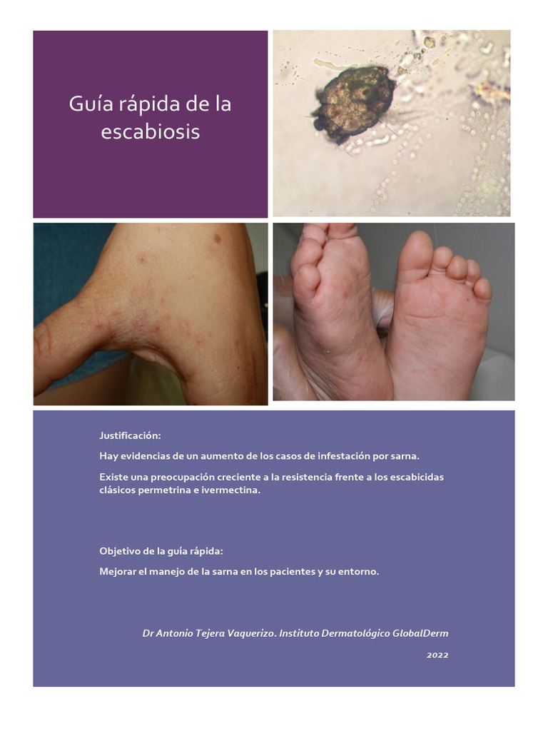 Guía rápida de la escabiosis | PDF