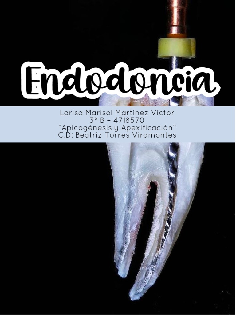 Apicogenésis y Apexificacion | PDF | Especialidades Medicas