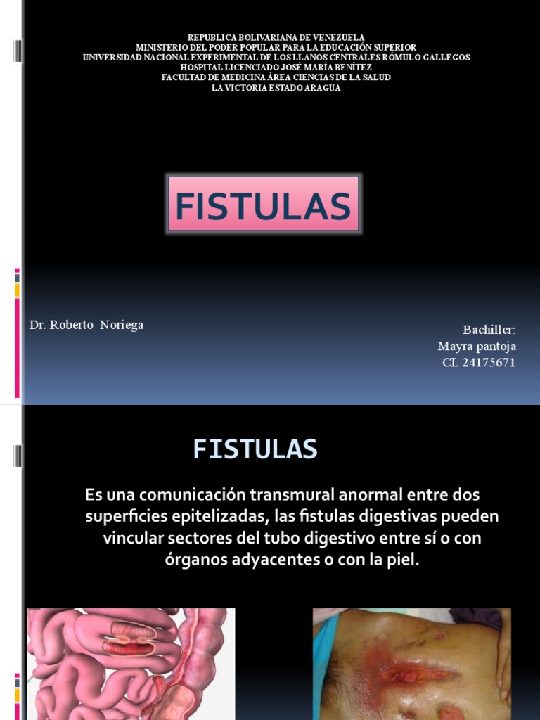 Características clínicas y clasificación de las fistulas digestivas | PDF | Septicemia ...