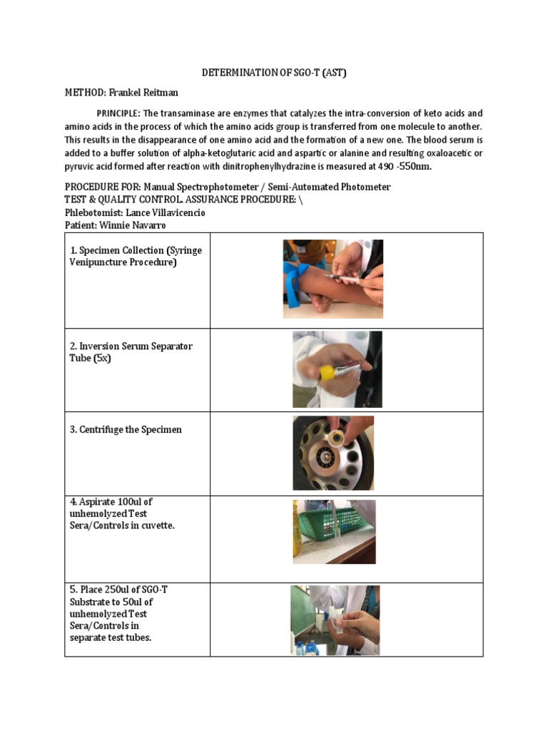 SGO-T (AST) Test Procedure & Results | PDF