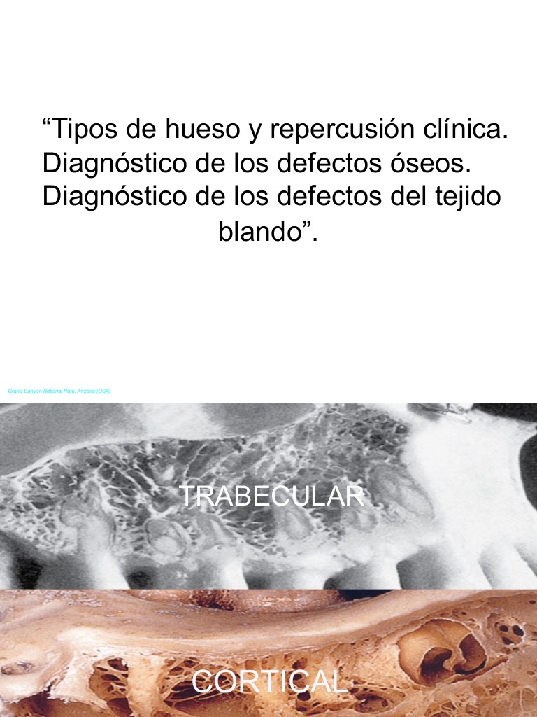 AlumnosClasificación defectos óseos | PDF | Hueso | Microscopía