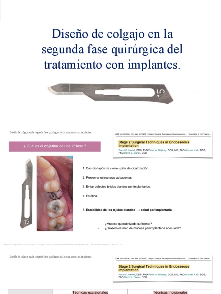 Diseño de Colgajo en Segunda Fase de Implantes | PDF