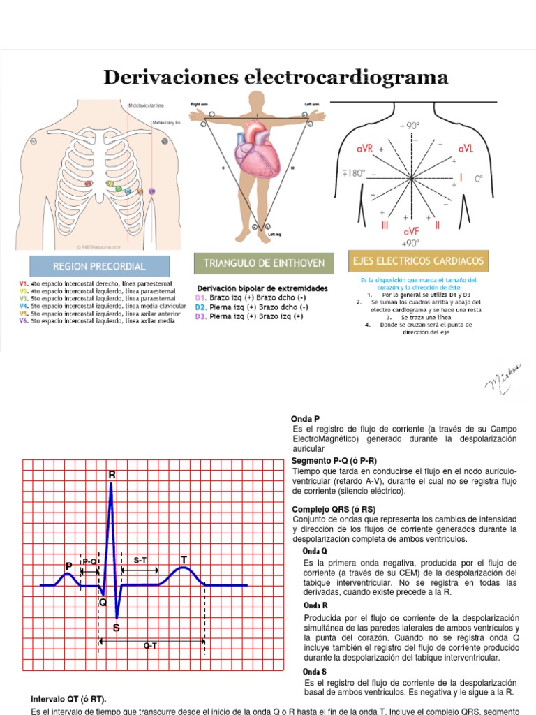 Interpretacion_basica_del_ECG | PDF | Electrocardiografia | Frecuencia