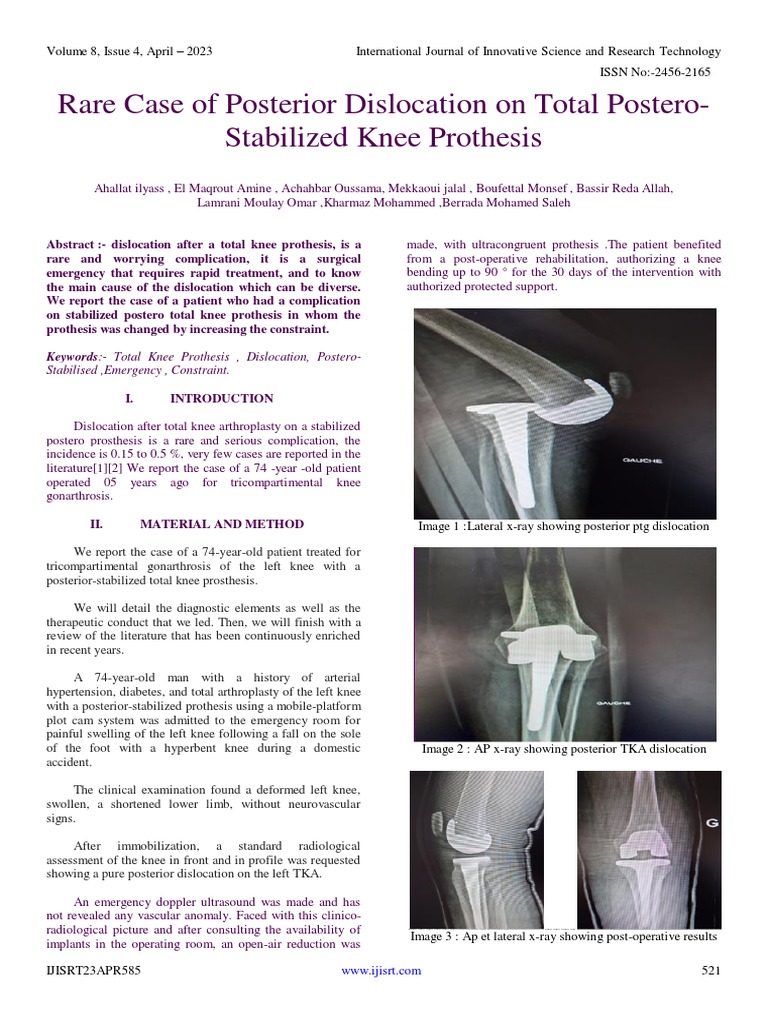 Rare Case of Posterior Dislocation On Total PosteroStabilized Knee ...