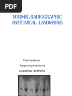 Normal Radiographic Anatomy of Maxilla & Mandible | PDF | Human Tooth ...
