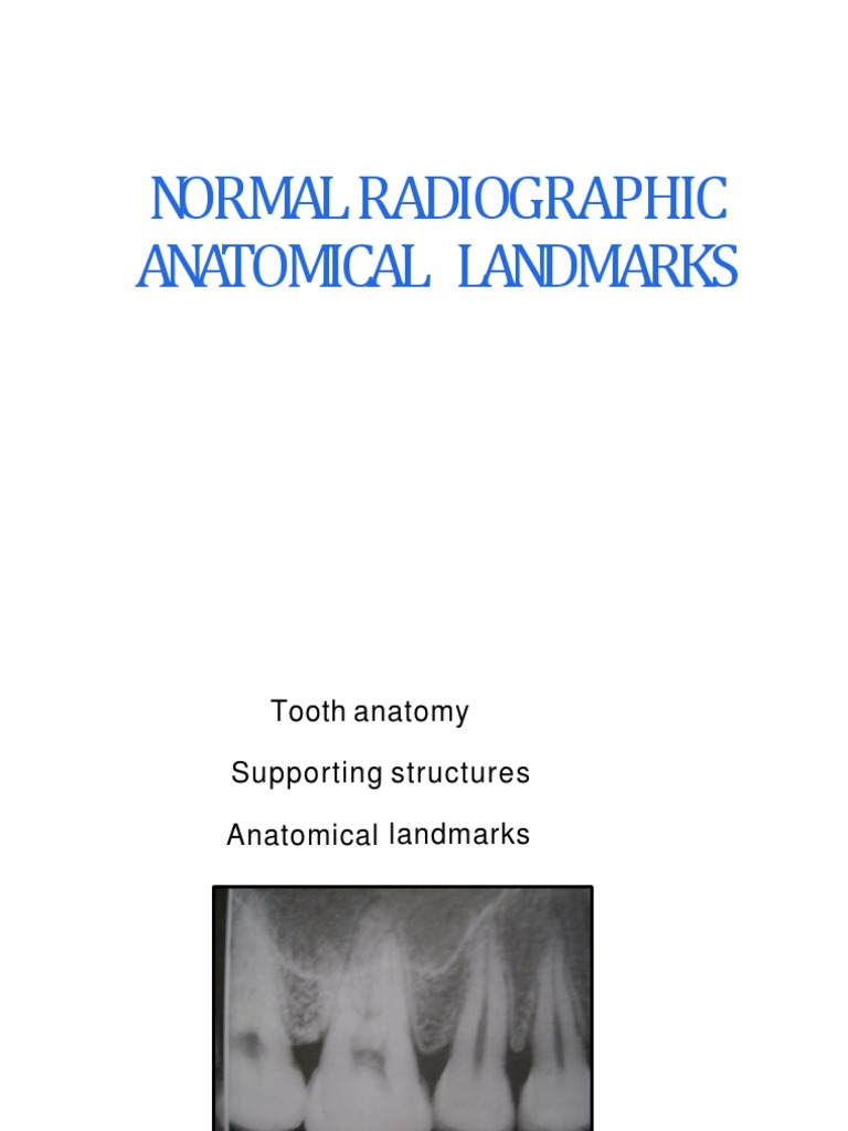 Lec 16 Normal Radiographic Anatomy | PDF | Dentistry Branches | Mouth