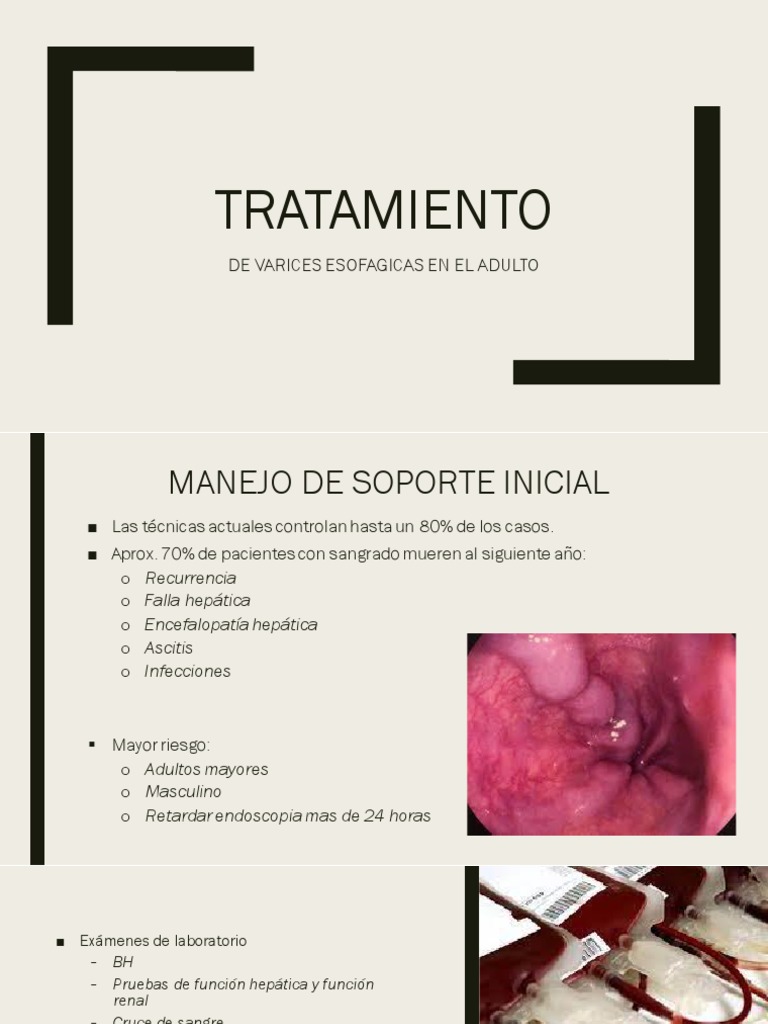 TX Varices Esofagicas | PDF | Tratamientos médicos | Drogas