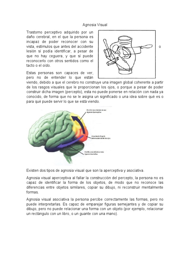 Agnosia Visual | PDF