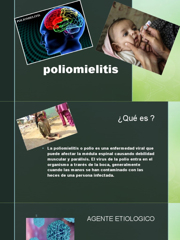 Poliomielitis | PDF | Enfermedades y trastornos | Epidemiología