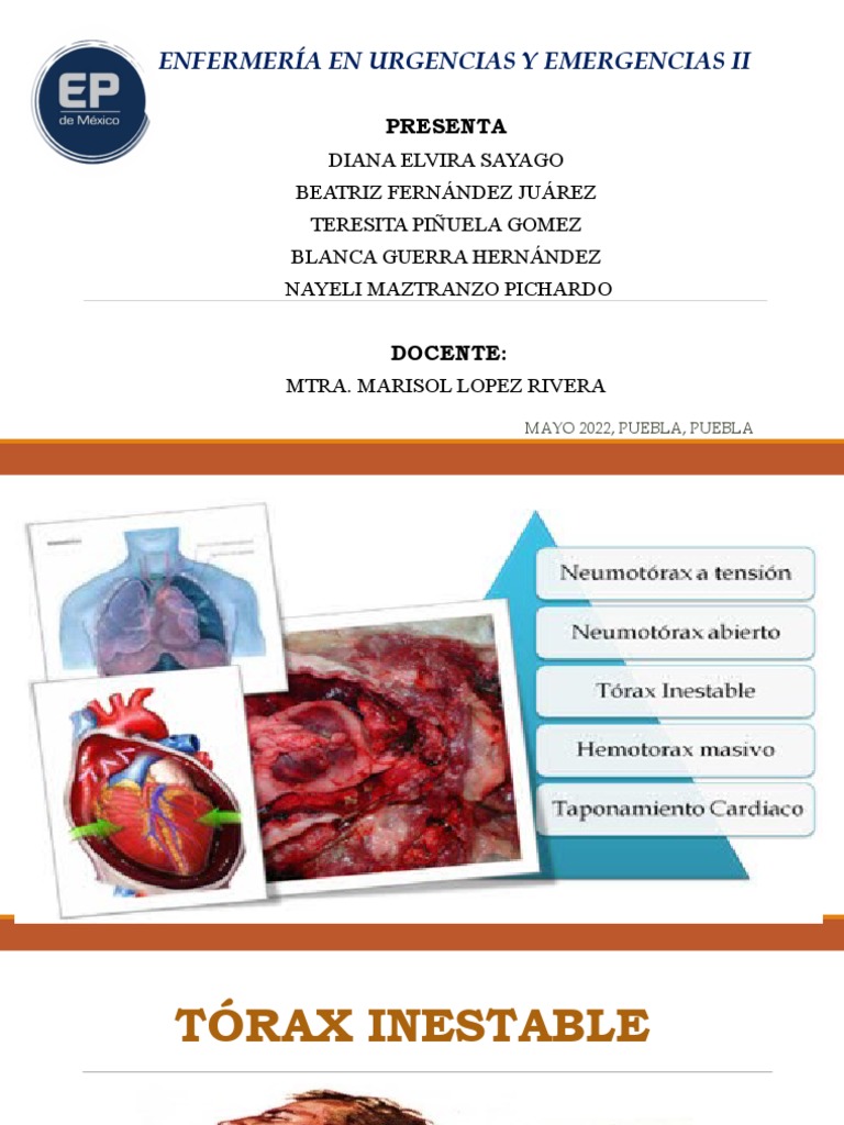 Torax Inestable Equipo 2 | PDF | Lesión | Respiración