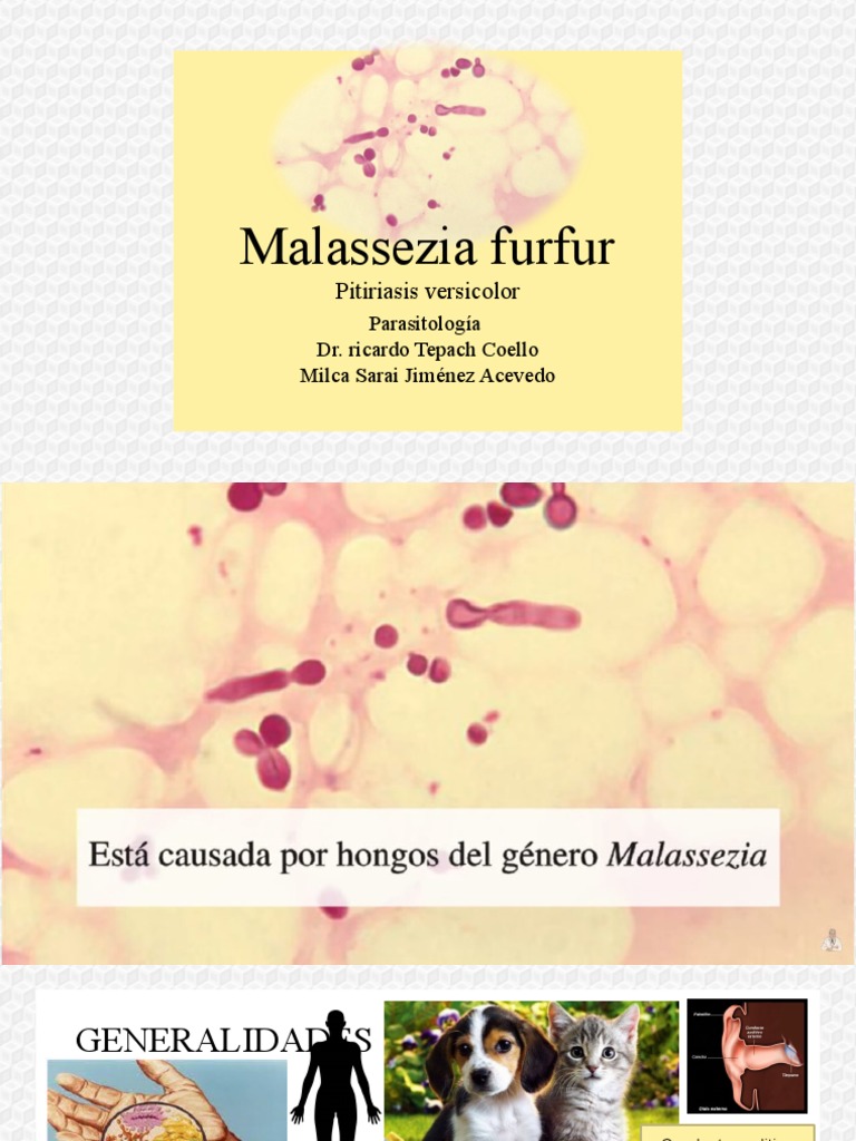 21 Malassezia Furfur | PDF | Micología | Piel