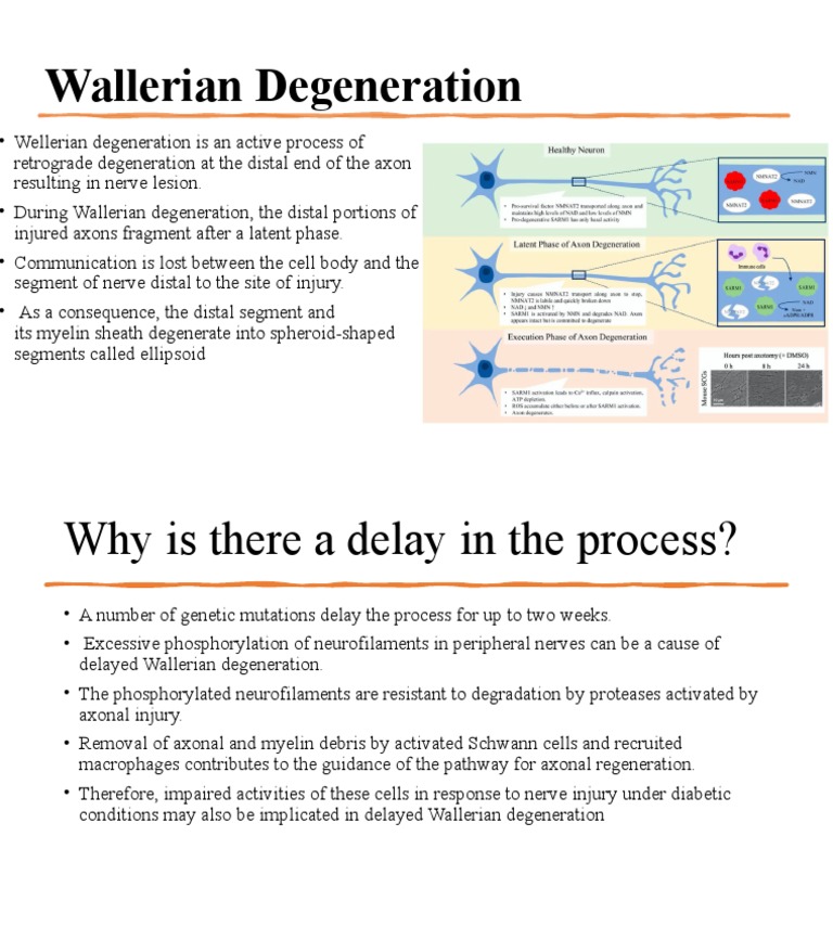 Neurology Insights: Wallerian Degeneration | PDF