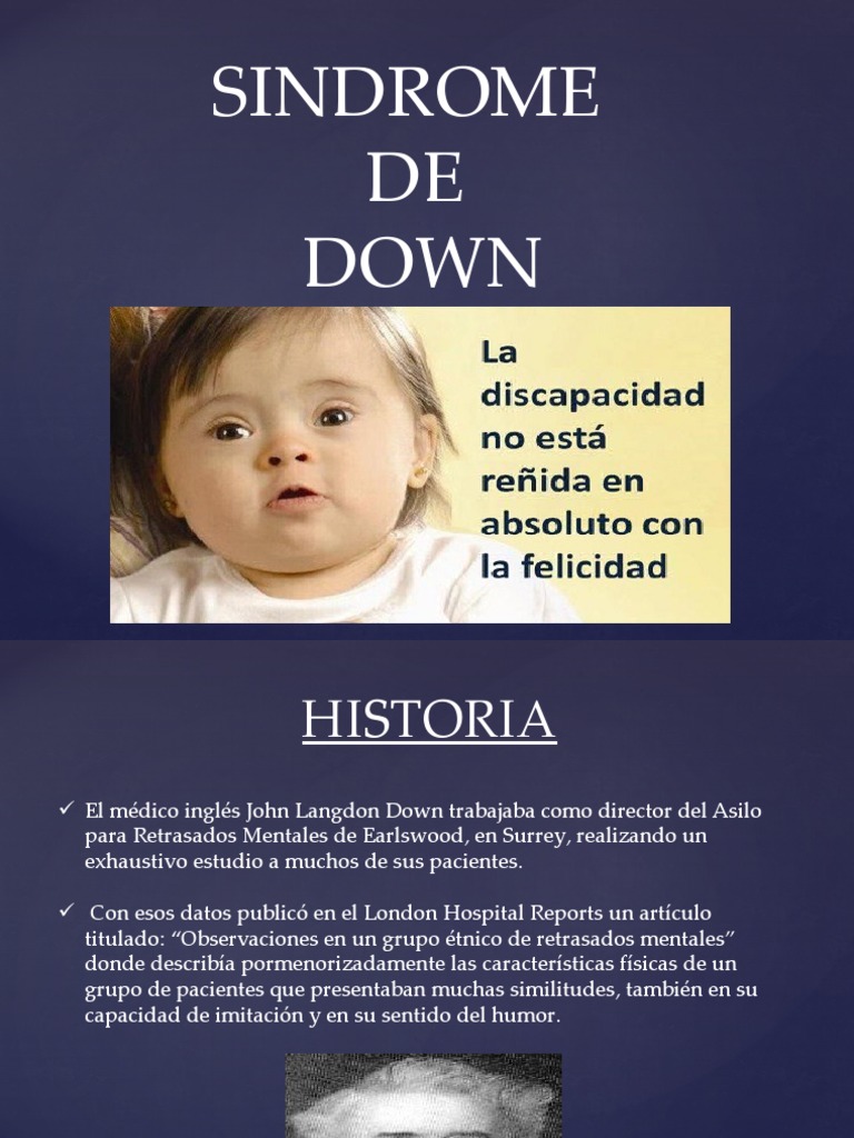 SINDROME de Down Power Point 21 | Descargar gratis PDF | Síndrome de Down | Medicina