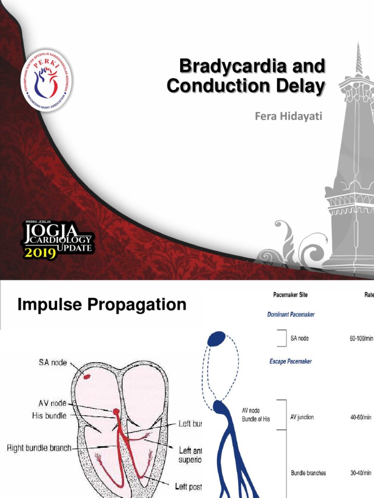 All About Bradycardia and Conduction Disturbance | PDF ...