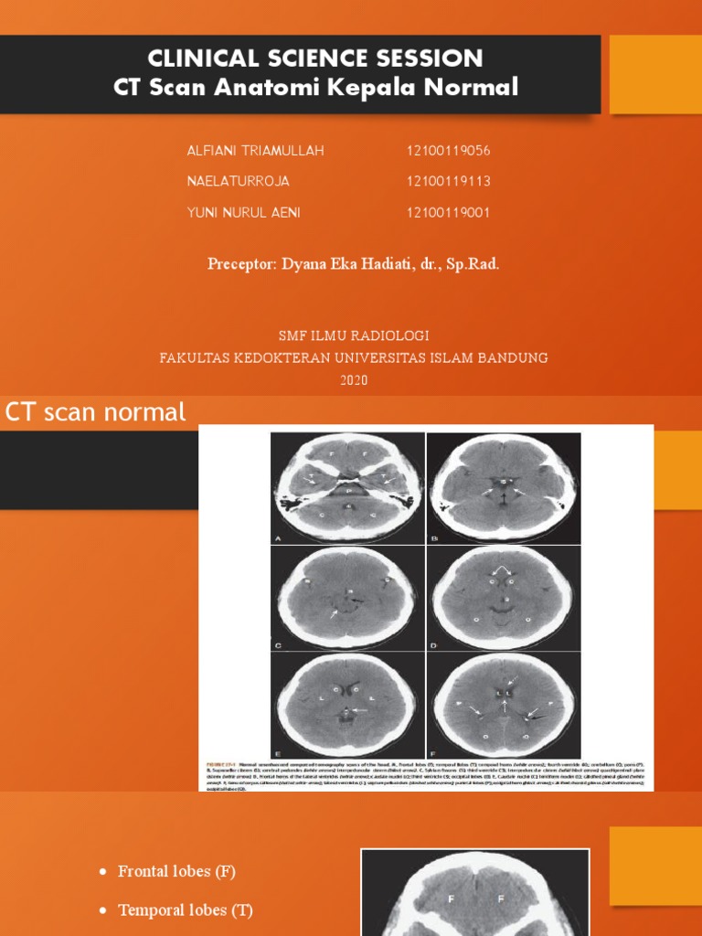 Clinical Science Session CT Scan Anatomi Kepala Normal: Preceptor ...