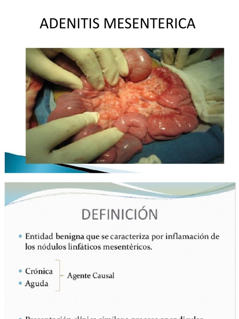 Adenitis Mesenterica | PDF