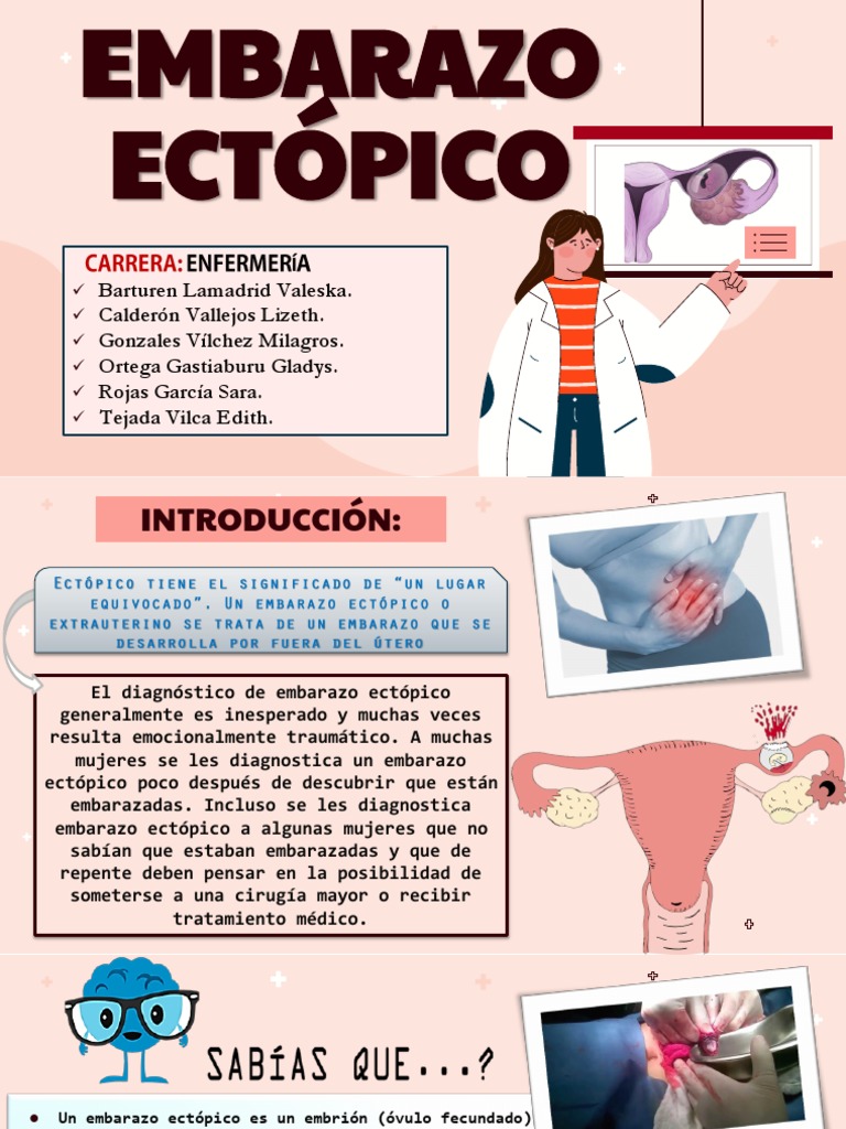 EMBARAZO ECTOPICO- | PDF | El embarazo | Salud pública