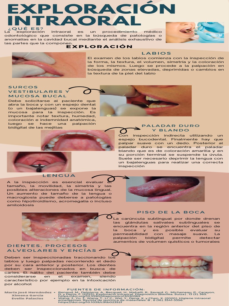 Infografía Exploración Intraoral | PDF | Boca | Lengua