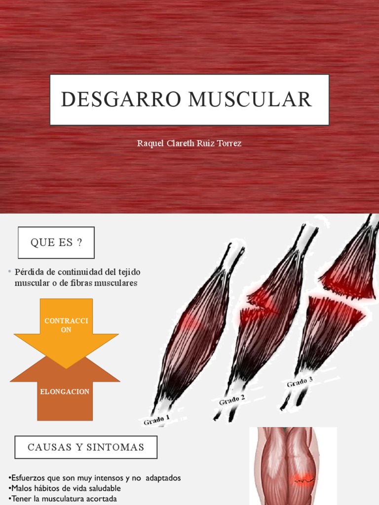 Desgarro Muscular Int | PDF