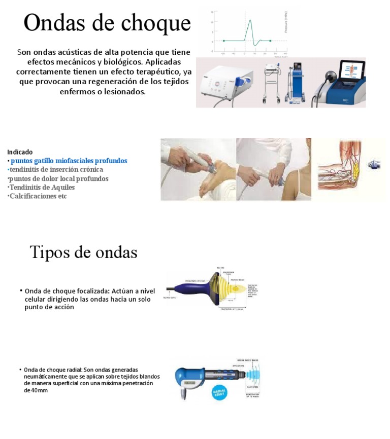 Tipos de Ondas de Choque Terapéuticas | PDF | Relaciones personales ...