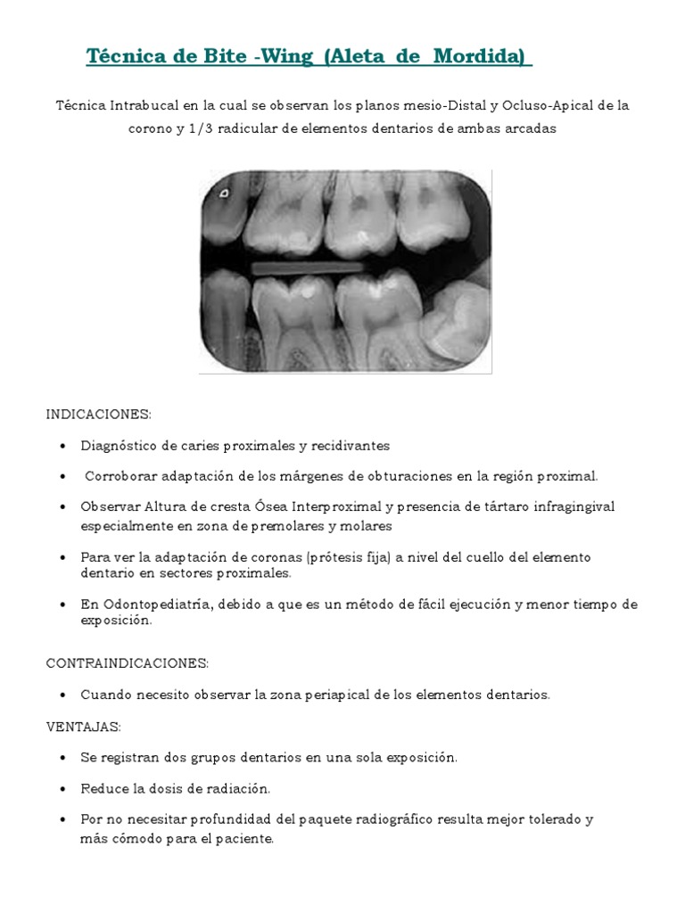 Técnica de Bite-Wing | PDF