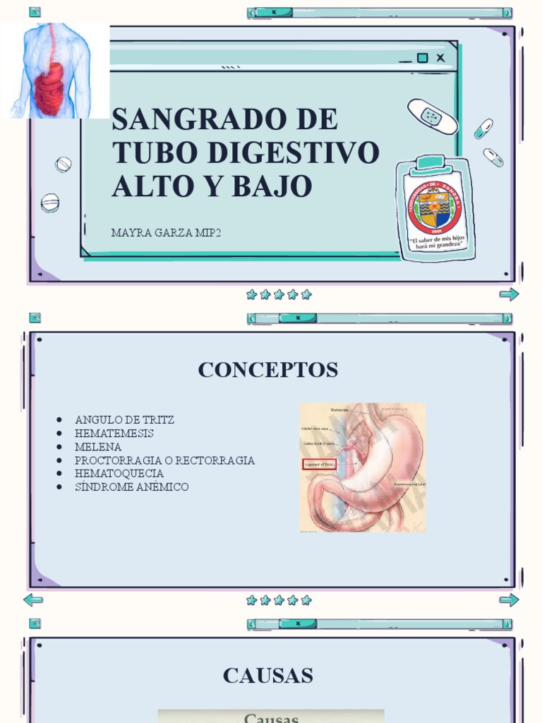 Sangrado de Tubo Digestivo Alto Y Bajo: Mayra Garza Mip2 | PDF | Medicina | Enfermedades digestivas