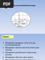 Interpretasi Lengkap EKG 12 Lead | PDF