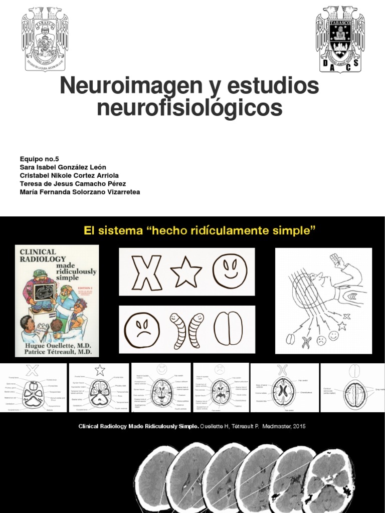 NEUROIMAGEN | PDF | Nervio | Electromiografia