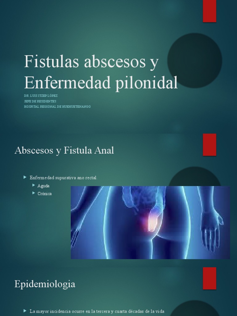 Fistulas Abscesos y Enfermedad Pilonidal: Dr. Luis Itzep López Jefe de ...