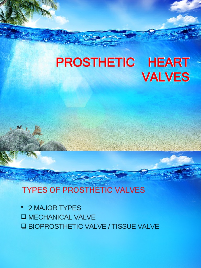 Prosthetic Heart Valves Pdf Internal Medicine Heart