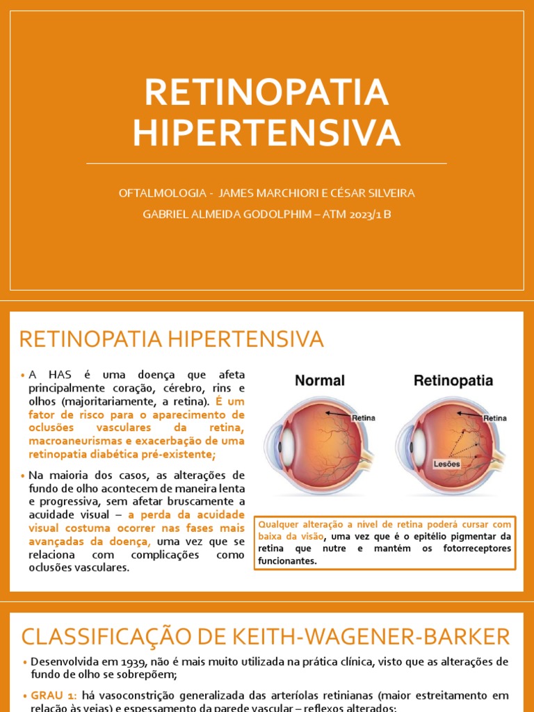 RETINOPATIA HIPERTENSIVA | PDF | Glaucoma | Doenças e distúrbios