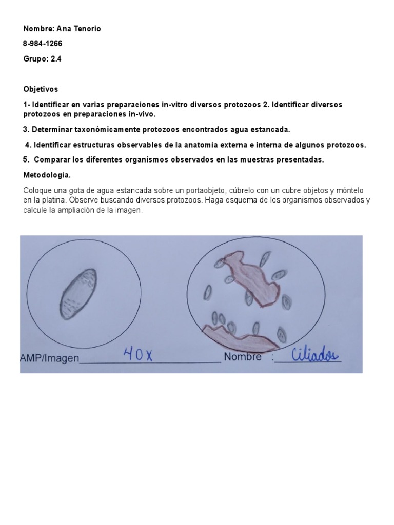 Diversidad Eucariotica Unicelular Grupo Protozoo | PDF | Filogenética ...