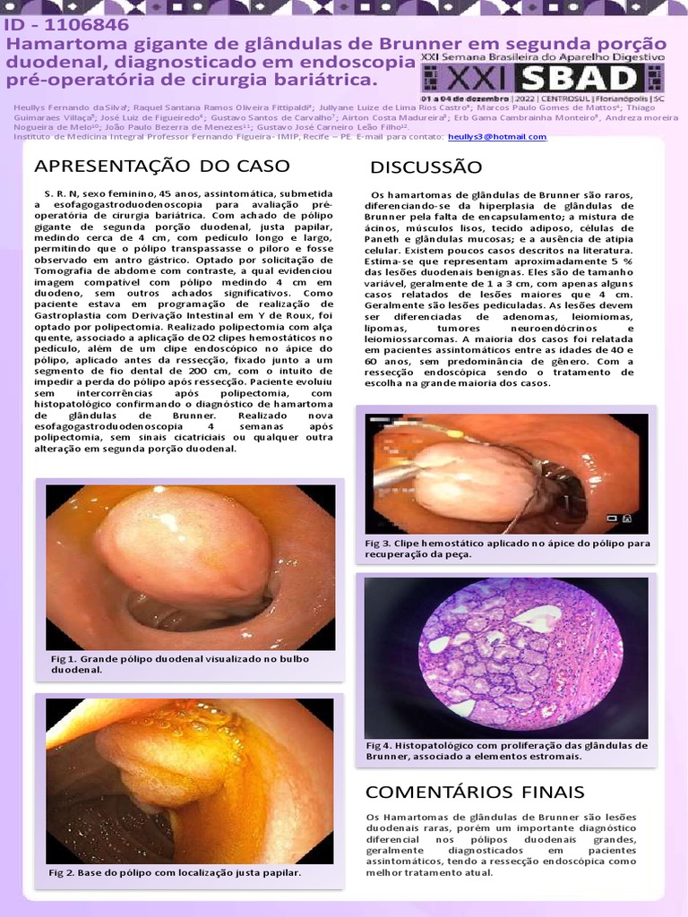 Eposter Sbad Hamartoma de Glândulas de Brunner | PDF | Cirurgia ...