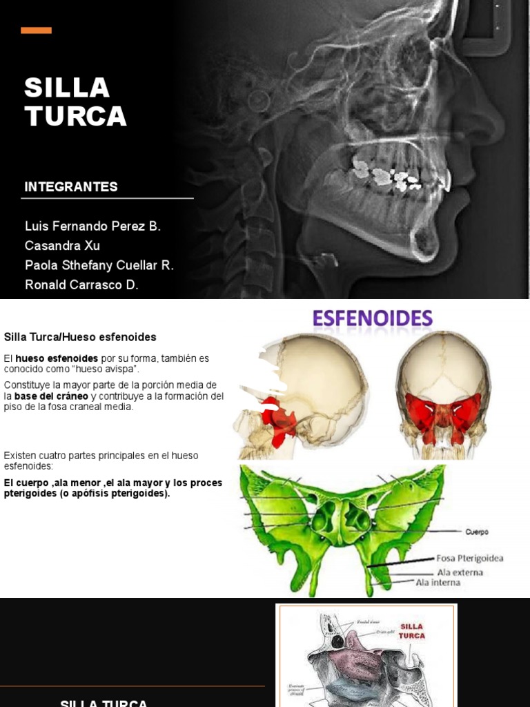 Silla Turca: Integrantes | Descargar gratis PDF | Cabeza y cuello ...