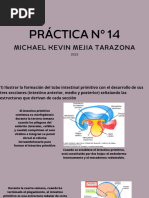 Persistencia del Conducto Onfalomesentérico | PDF | Anatomía ...