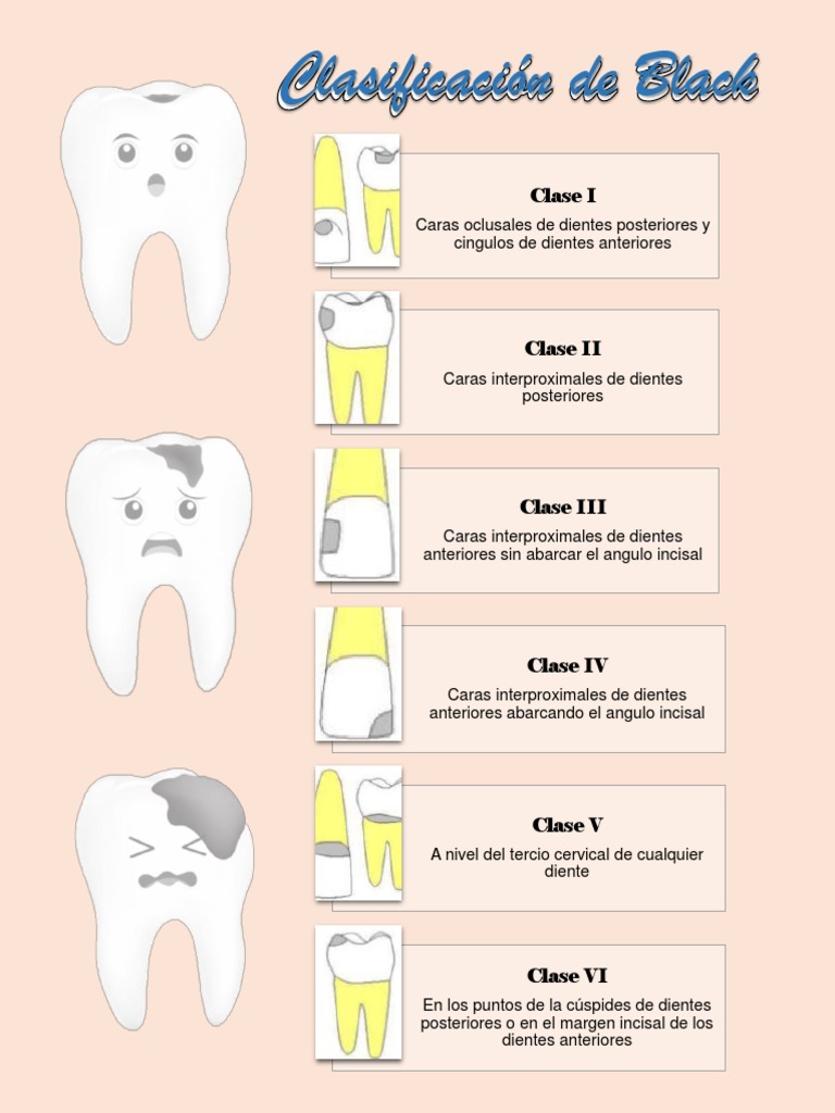 Clasificación de Black, Infografia | PDF