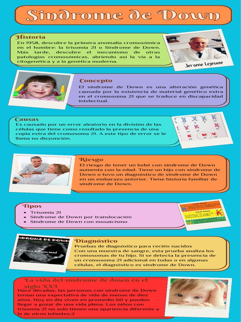 Sindrome de Down | PDF