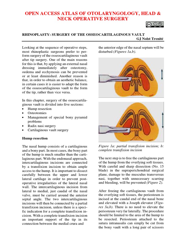 Open Access Atlas of Otolaryngology, Head & Neck Operative Surgery | PDF | Human Nose | Medical ...