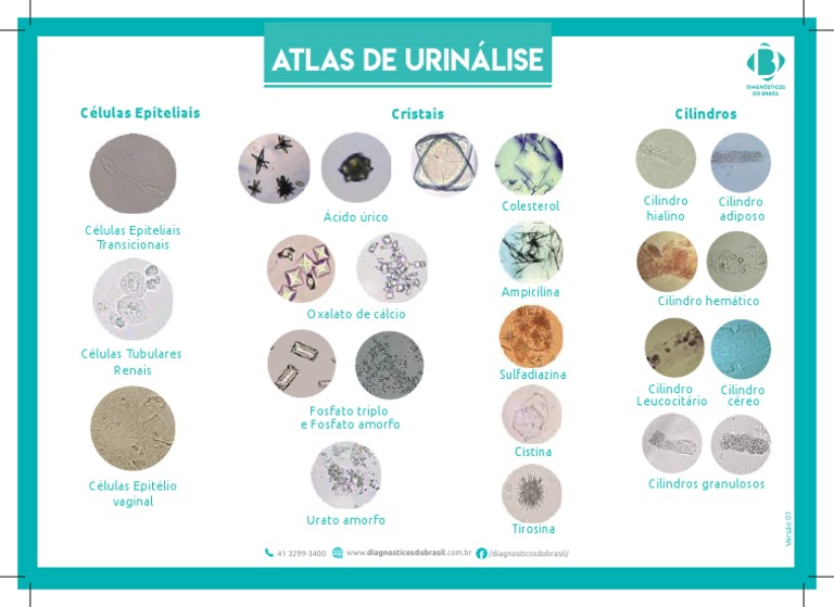 Atlas de Urinalise1 | PDF
