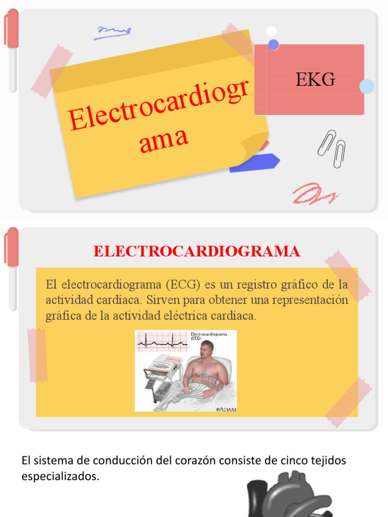 Electroc Ardiogr Ama | PDF | Electrocardiografia | Electrofisiología ...