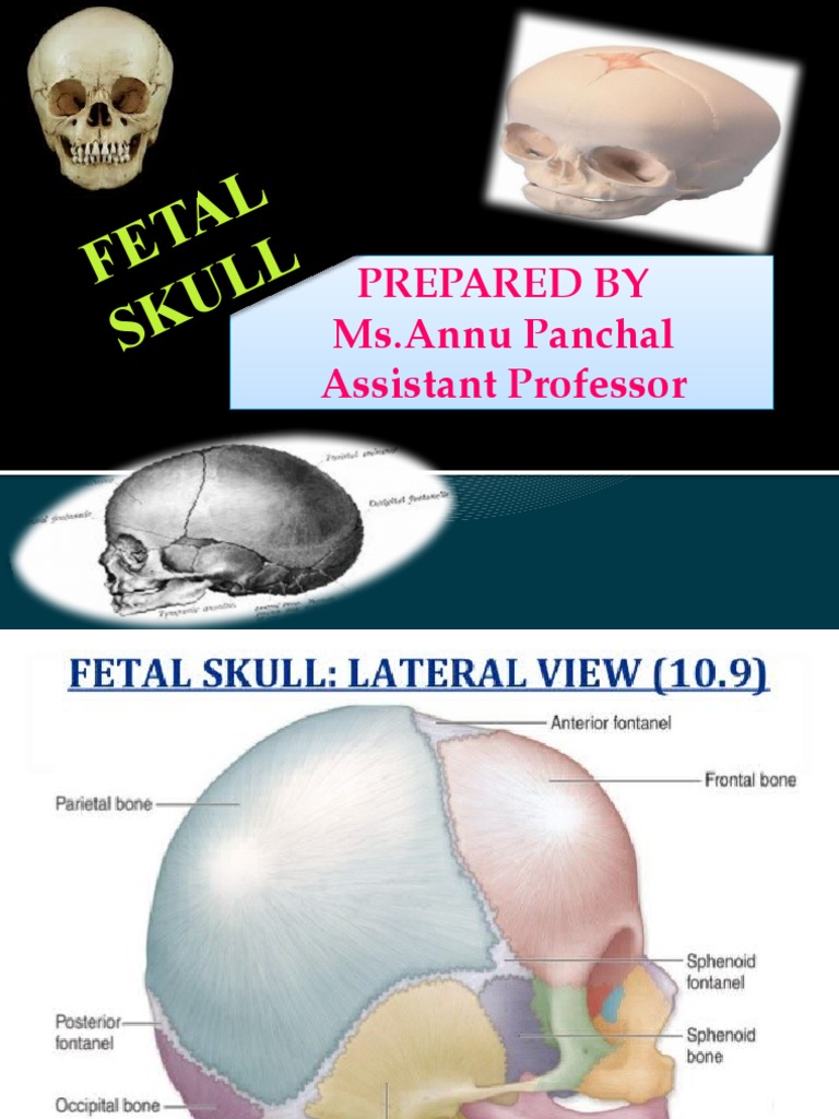 Fetal Skull | PDF | Skull | Skeletal System